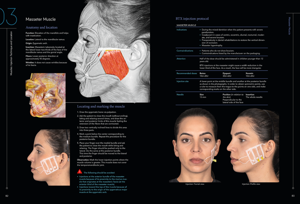 Botulinum Toxin for Facial Harmony: How this Unconventional Treatment ...